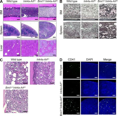 Enhanced Megakaryocytopoiesis And Massive Myelofibrosis Induced By