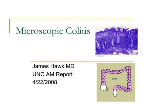 Ppt Microscopic Colitis Powerpoint Presentation Free Download Id1264564