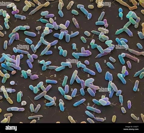Salmonella Bacteria Coloured Scanning Electron Micrograph Sem Of