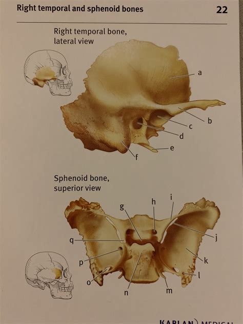 Bones Skull Right Temporal Sphenoid Bone Diagram Quizlet