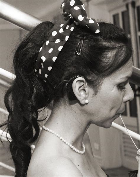 6 Meses De Implante Coclear Bilateral Lak Lobato