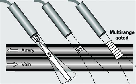 Schematic Illustration Of Cw Pw And Multirange Gated Pw Doppler