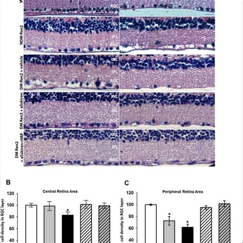 Onl Outer Nuclear Layer Opl Outer Plexiform Layer Inl Inner