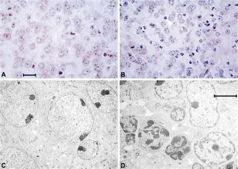 Histology And Electron Microscopy High Power Photomicrographs Of