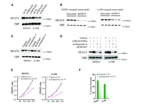 Inhibition Of Trpv4 Calcineurin Suppresses Nfat4 Activation A