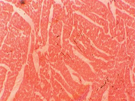 Effects Of Ellagic Acid And Oxidized Tallow Alone Or In Combination On