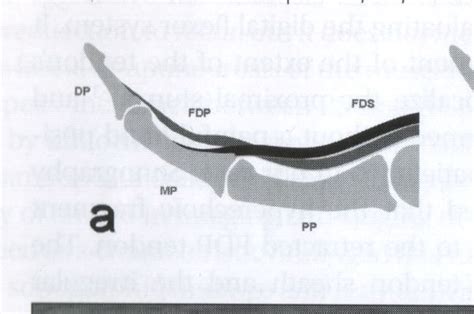 A Gallery Of High Resolution Ultrasound Color Doppler And 3d Images