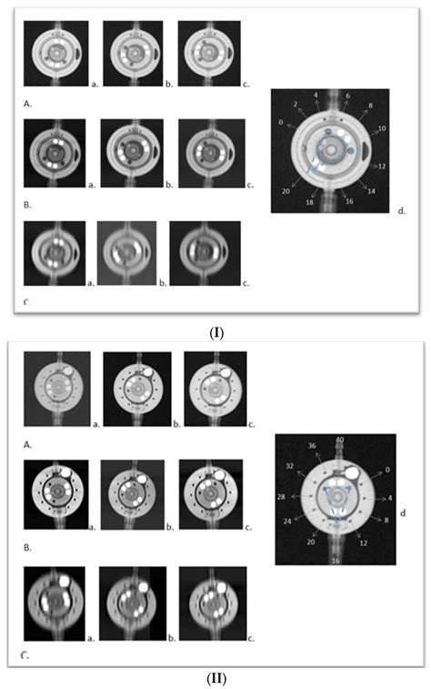 Three Dimensional Visualization Of Shunt Valves With Photon Counting Ct And Comparison To