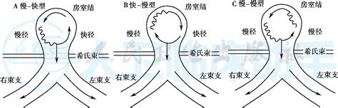 心电图详情 心电图 人卫临床助手 人民卫生出版社