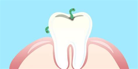 牙齿被蛀空却又不疼，难道要放任不管吗？ 知乎
