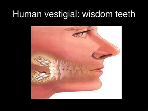 Humans With Vestigial Gills