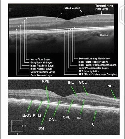 Layers Retina Attachment Php Attachmentid D The Retina Optometry Education
