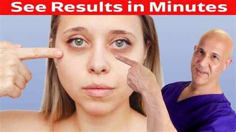 Pin On Eyes Dark Circles