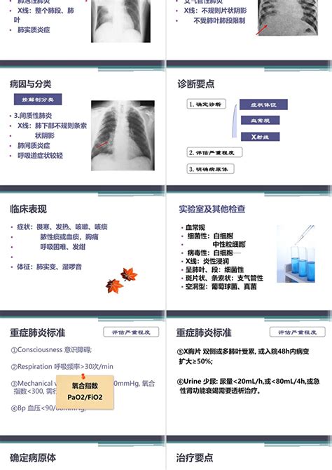 Ppt