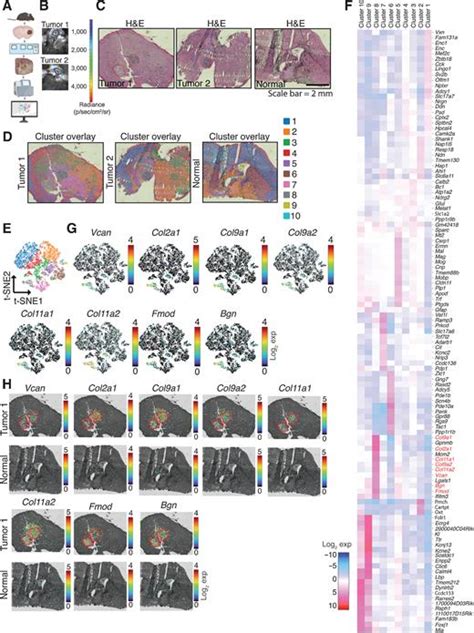 single cell spatial analysis identifies regulators of brain tumor