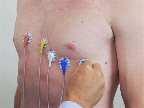 12 Lead ECG Placement ECG Leads Position ADInstruments