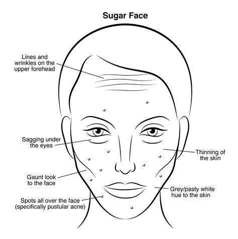 Gut Health And Skin Problems Popsugar Beauty Australia