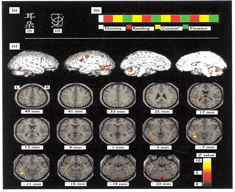 A Left Lateralized Network For Reading Chinese Words A 3 T Neuroreport