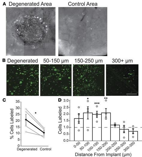 JCI Insight Local Photoreceptor Degeneration Causes Local