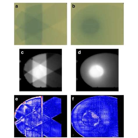 A Comparison Of The Gamma Index Analysis For A 3d Crt Left Column And