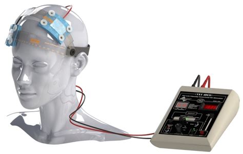 Direct Current Transcranial Stimulation Mirandasmsblog