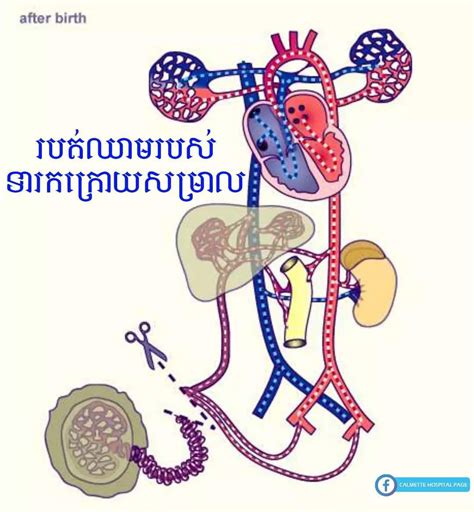 មូលហេតុដែលបណ្តាលអោយលើសសម្ពាធឈាមក្នុងសួតលើទារកទើបនឹងកើត នគរដ្រេហ្គន