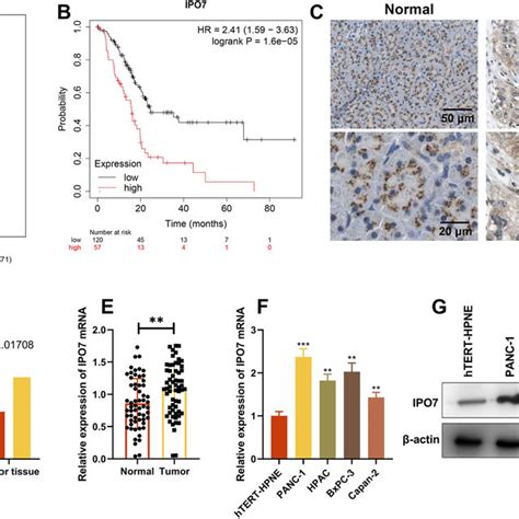 Invasion Migration And Gene Expression Of Mda Mb 231 And 231 Br