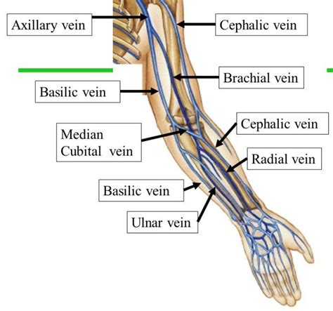 Deep Vein Thrombosis Arm Globalmumu