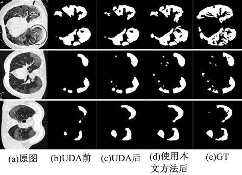基于最优传输特征选择的医学图像分割迁移学习