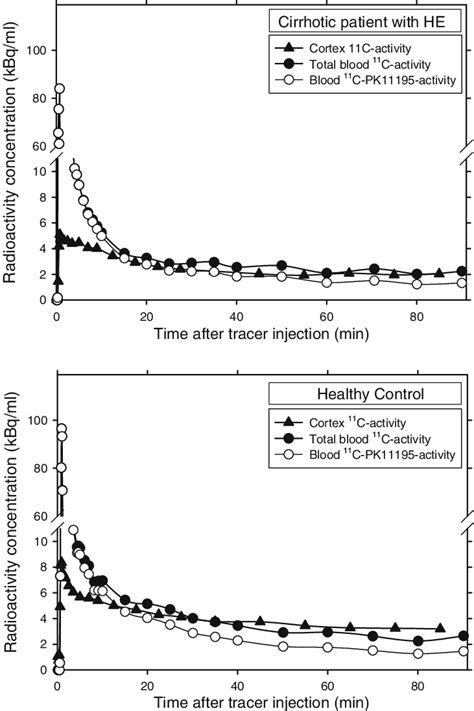 Time Courses Of Total 11 C Radioactivity And 11 C Pk11195 Radioactivity Download Scientific