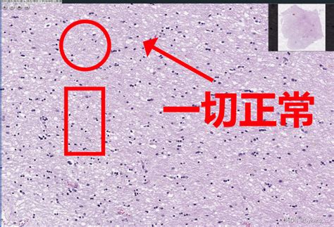 openseadragon在vue springboot框架下的使用（前后端衔接） vue openseadriagon csdn博客