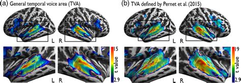 Neural Activation For Taskbased And Passive Vocalsound Processing