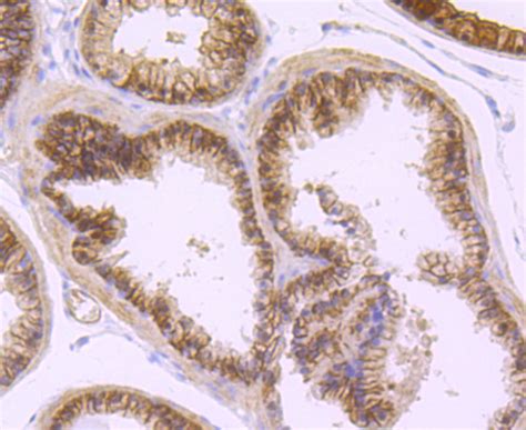Dclk1 Antibody Ma5 32657