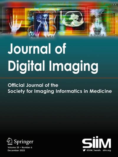 Integrating The Bids Neuroimaging Data Format And Workflow Optimization