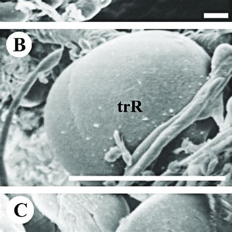 The Structure Of Hpv Adapted From Swiss Institute Of Bioinformatics Download Scientific