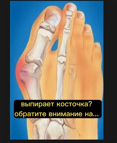 Выпирает косточка на ноге Ролан Сэнсэй Психология самоисцеления