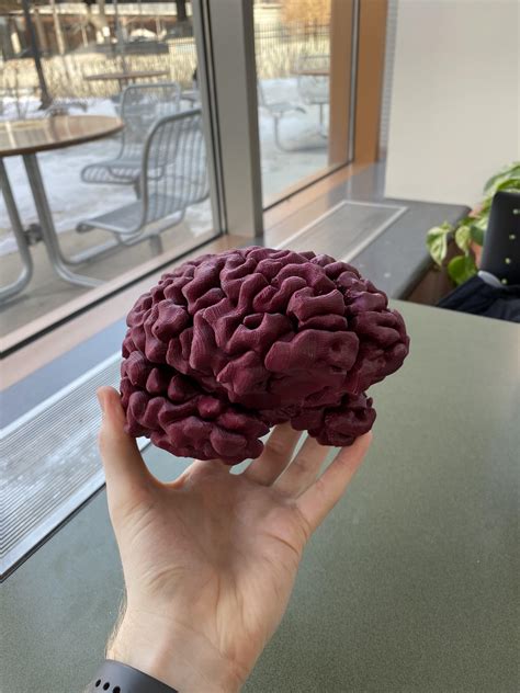 My Brain Finished Printing Yesterday After 88 Hours Computed From My Mri Scan Using Freesurfer
