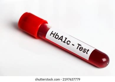 HbA C Chart HbA C Test Normal HbA C Level And HbA C Range OFF