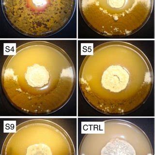 Cepas De Pseudonocardia P1 De Streptomyces S3 S4 S5 Y S9 Y Un