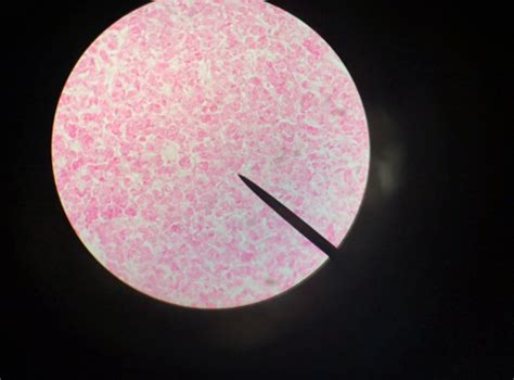 Endocrine Histology Flashcards Quizlet