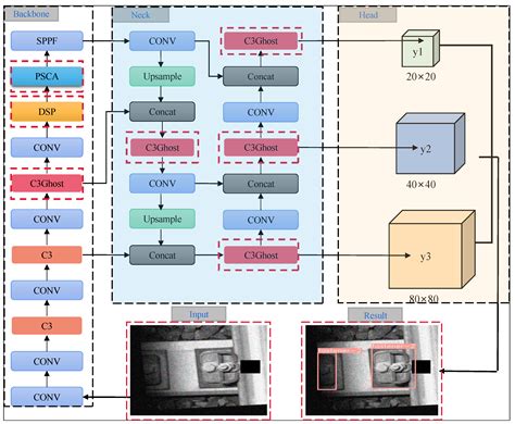 Dp Yolo A Lightweight Real Time Detection Algorithm For Rail Fastener Defects