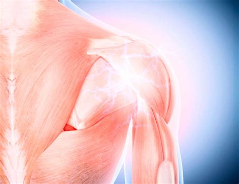 Trigger Point Therapy Explained Techniques And Benefits You Need To Know