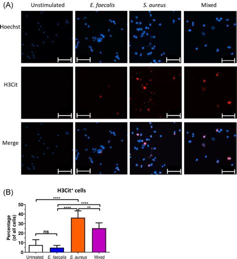 Enterococcus Faecalis Suppresses Staphylococcus Aureus Induced Netosis