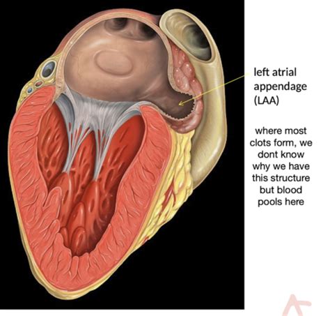 Cm Ii Cardio Afib Flutter Flashcards Quizlet