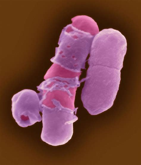 Antibiotic Treatment On Bacteria Photograph By Dennis Kunkel Microscopy