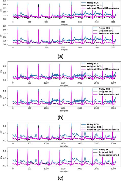 Figure 1 From Deep Neural Network Denoising Model Based On Sparse