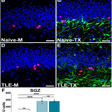 Transplantation Of Gabaergic Progenitors Does Not Increase Cell