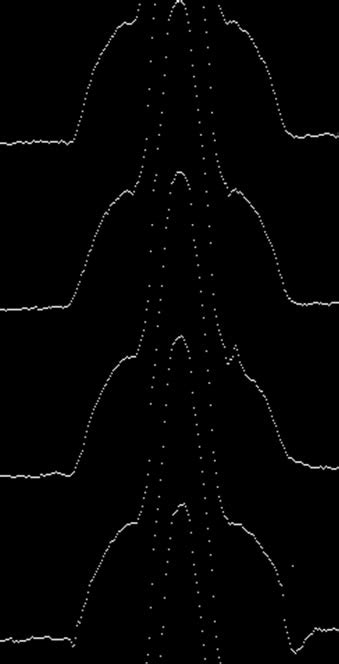 a new algorithm for automatic double bright fringe of multiple beam