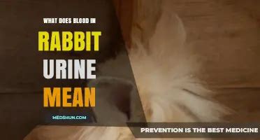 High Bilirubin And Urine What It Means Medshun
