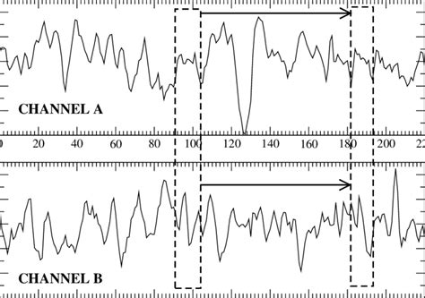 Synchronization Likelihood Sl Between Two Brain Regions Time Series